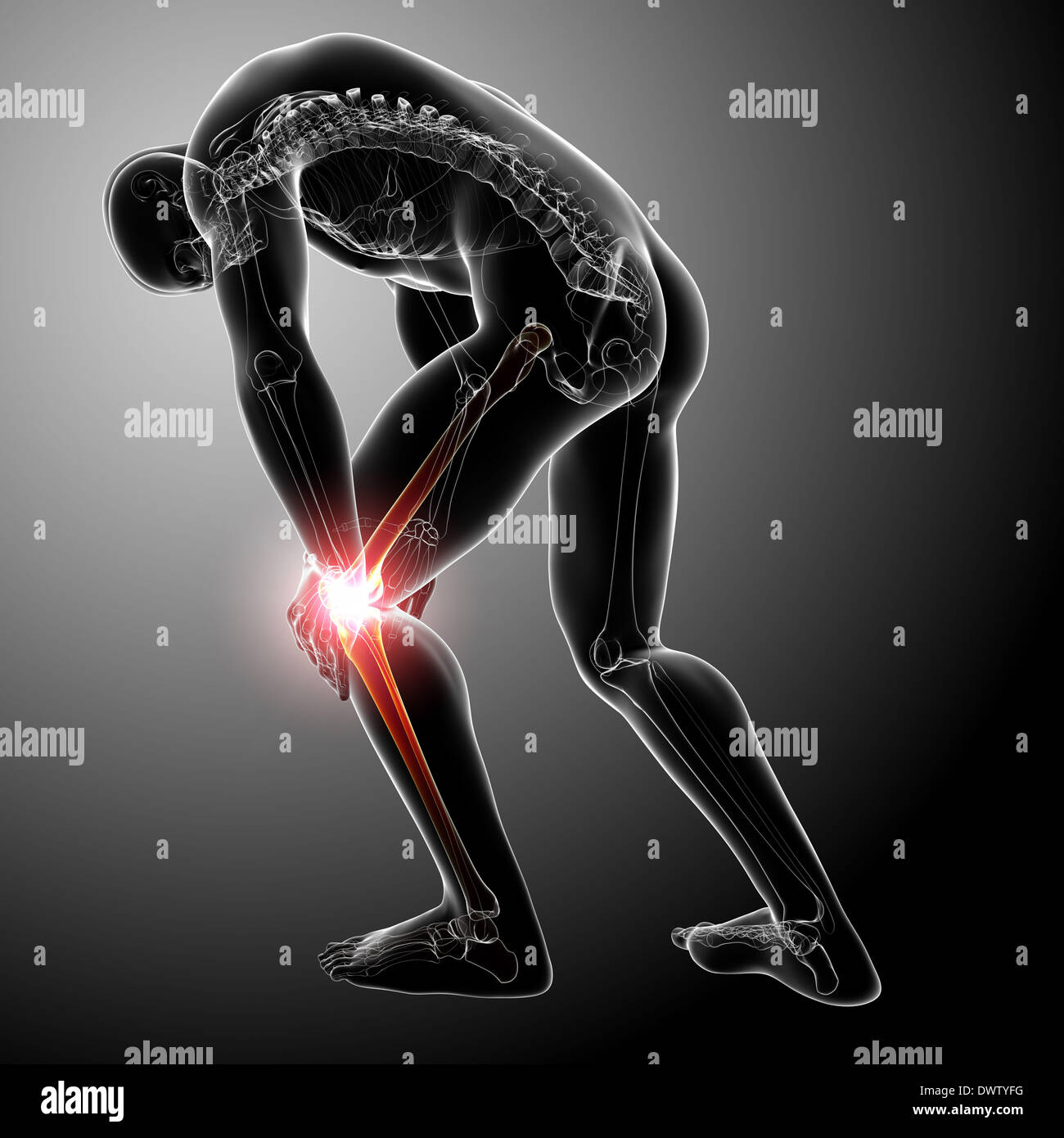 Pain knee man drawing hi-res stock photography and images - Alamy