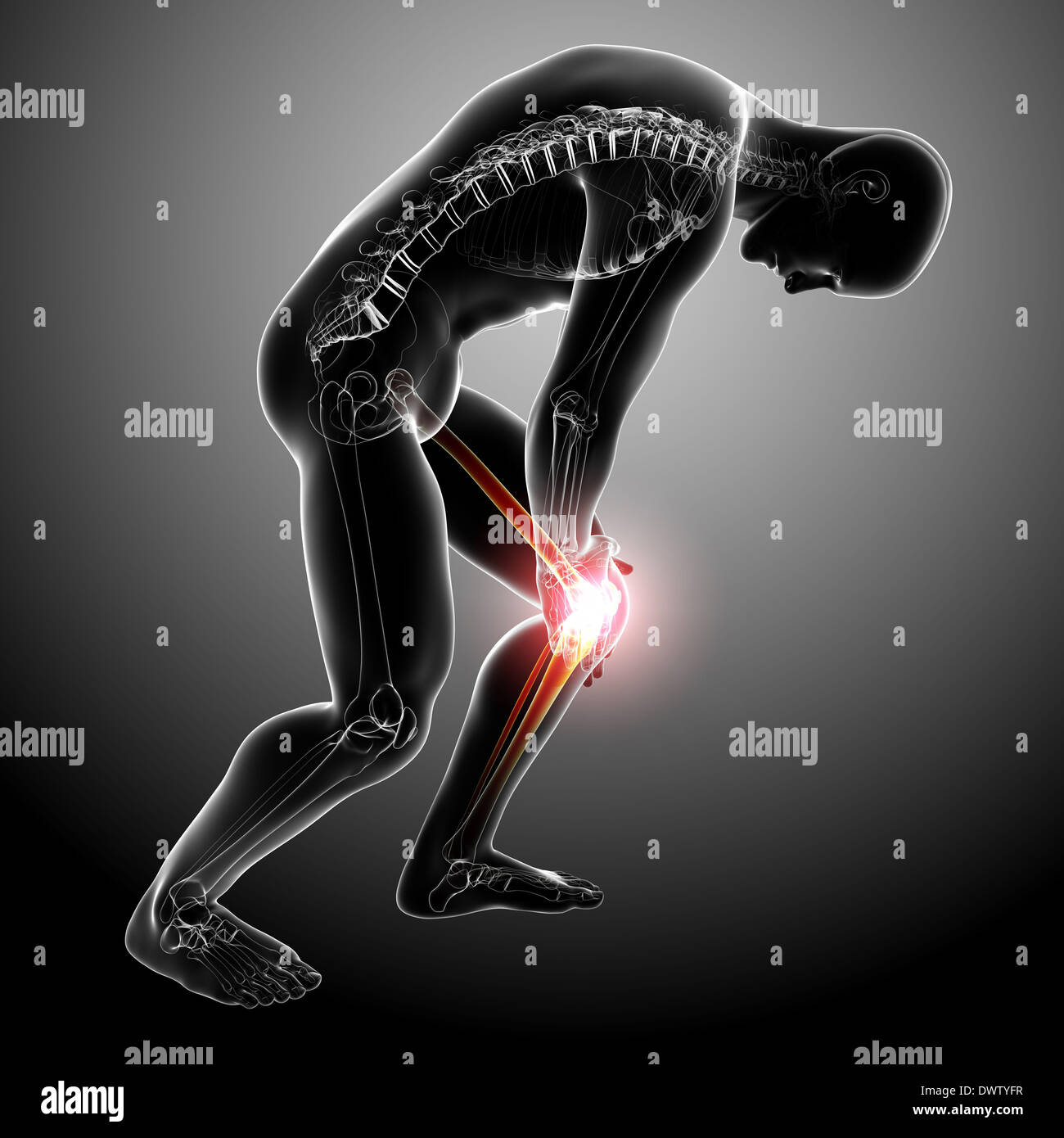 Pain knee man drawing Stock Photo - Alamy
