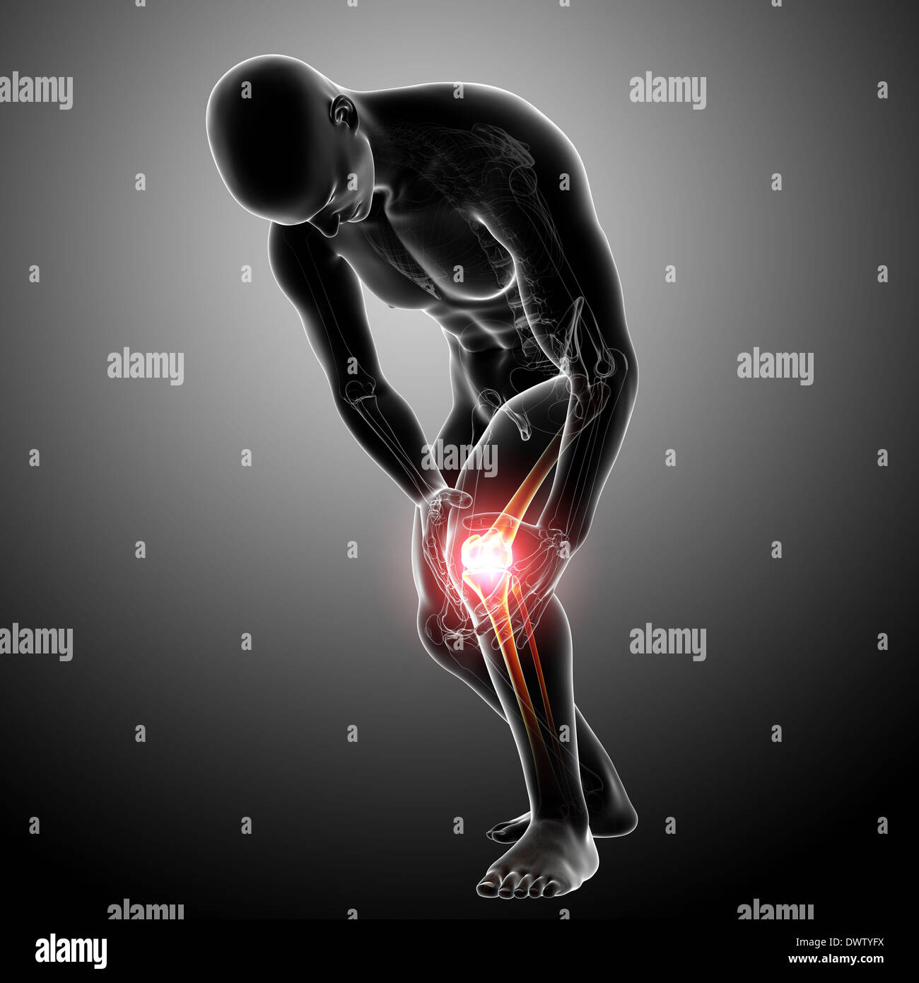 Pain knee man drawing Stock Photo - Alamy