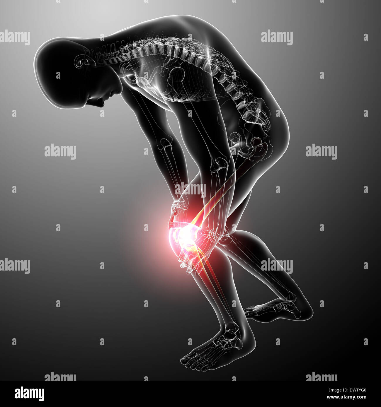Pain knee man drawing Stock Photo - Alamy