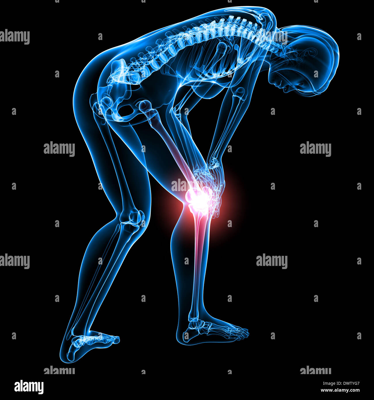 Knee pain woman drawing Stock Photo - Alamy