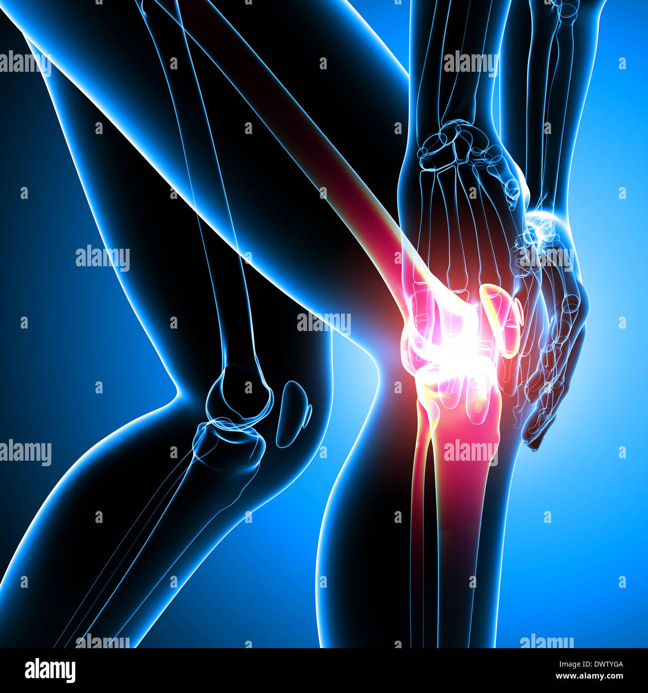 Knee pain drawing Stock Photo - Alamy