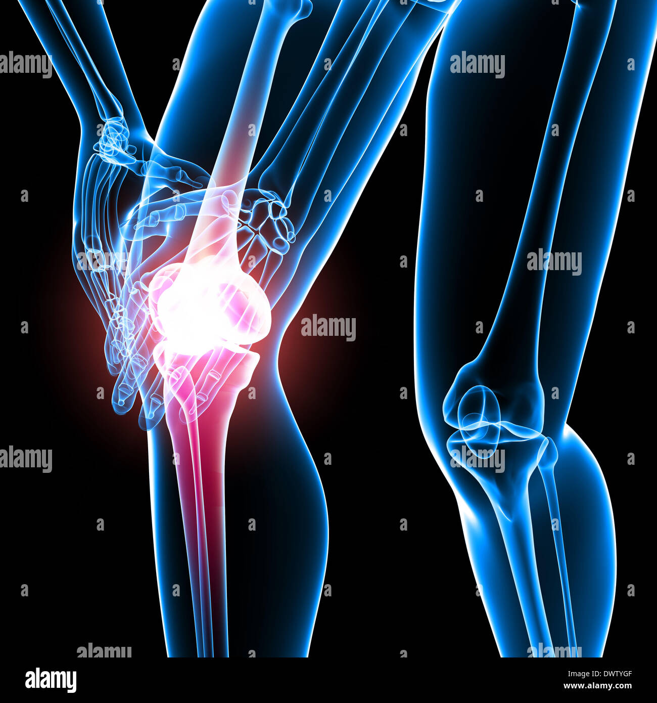 Knee pain drawing Stock Photo - Alamy