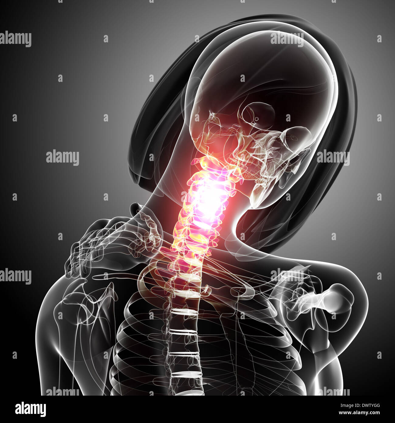 Cervicalgia woman drawing Stock Photo - Alamy