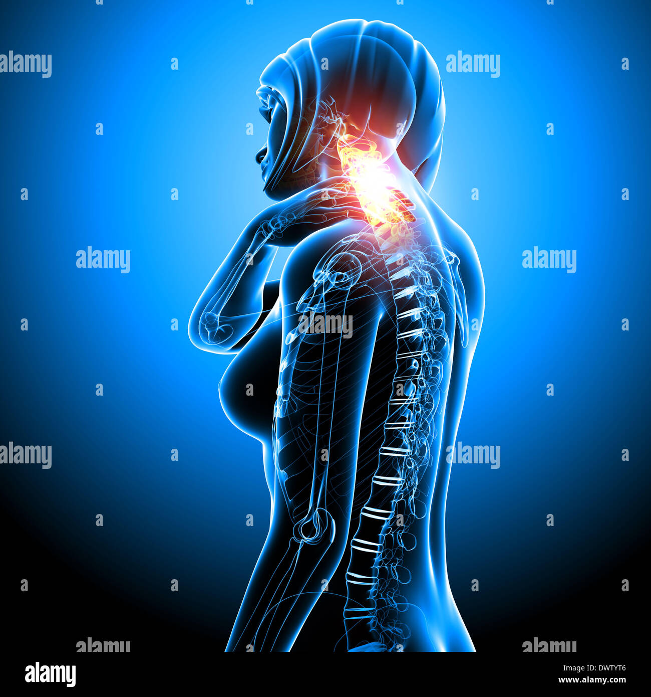 Cervicalgia woman drawing hi-res stock photography and images - Alamy