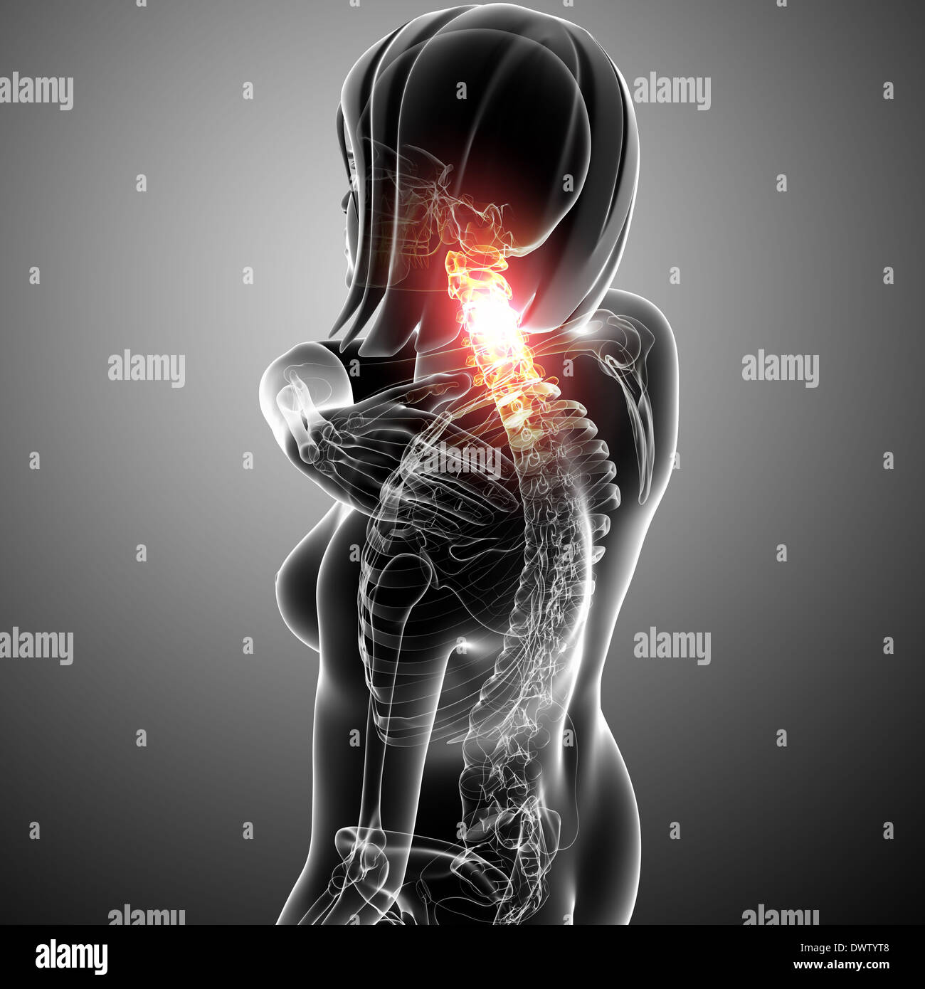 Cervicalgia woman drawing hi-res stock photography and images - Alamy