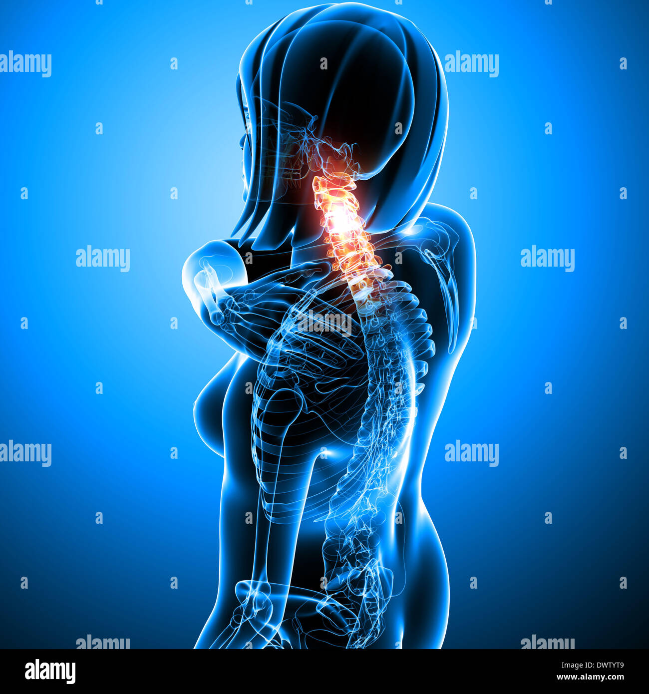 Cervical Cervicalgia High Resolution Stock Photography and Images - Alamy