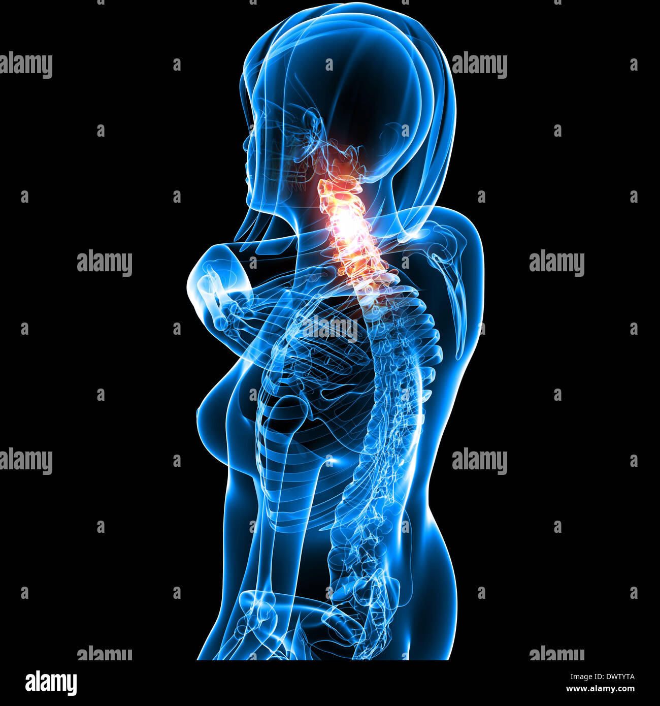 Cervicalgia woman drawing hi-res stock photography and images - Alamy