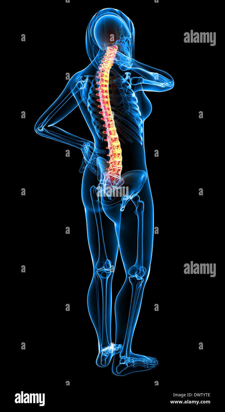 Back pain drawing Stock Photo - Alamy