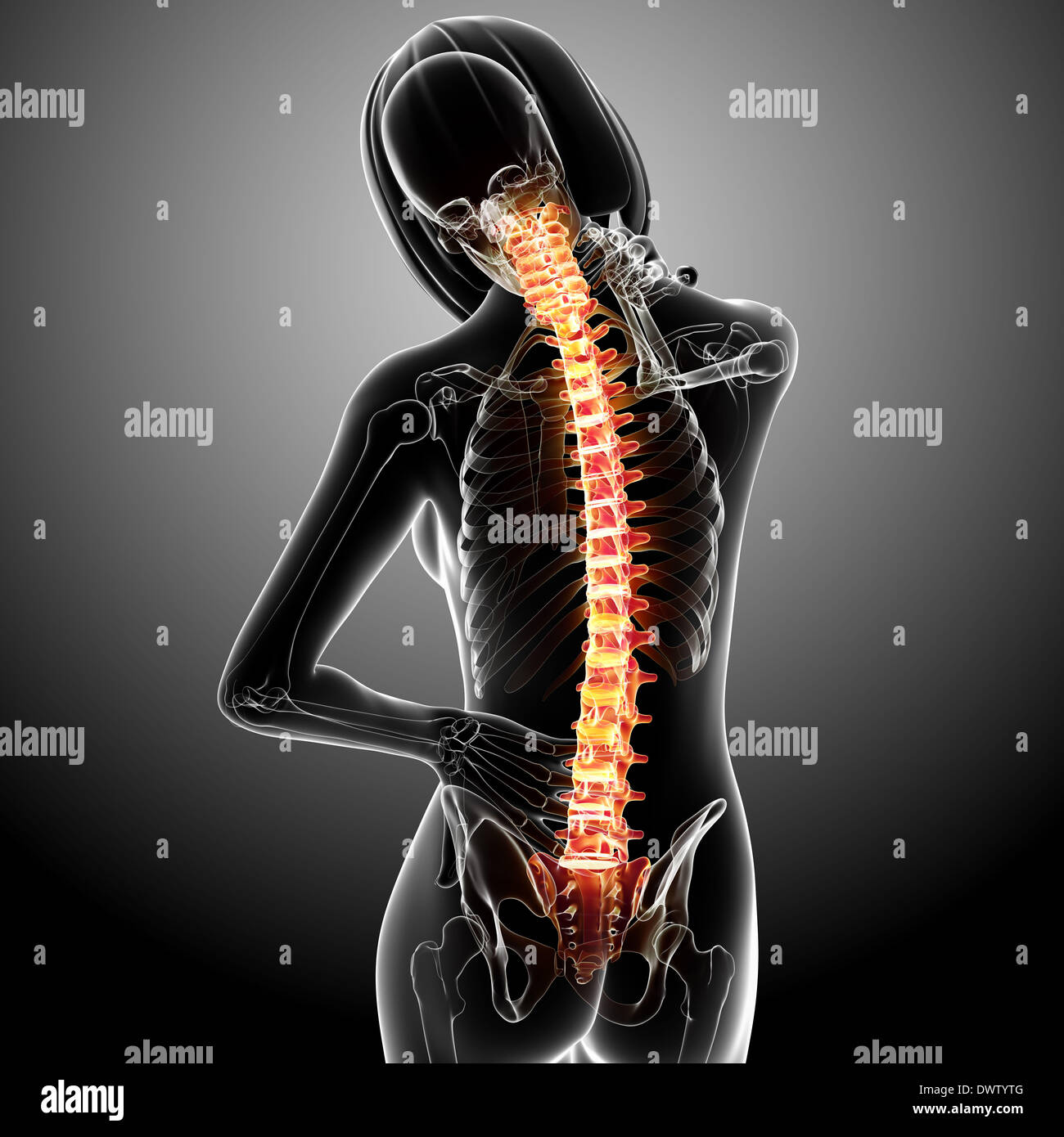 Back pain woman drawing Stock Photo - Alamy
