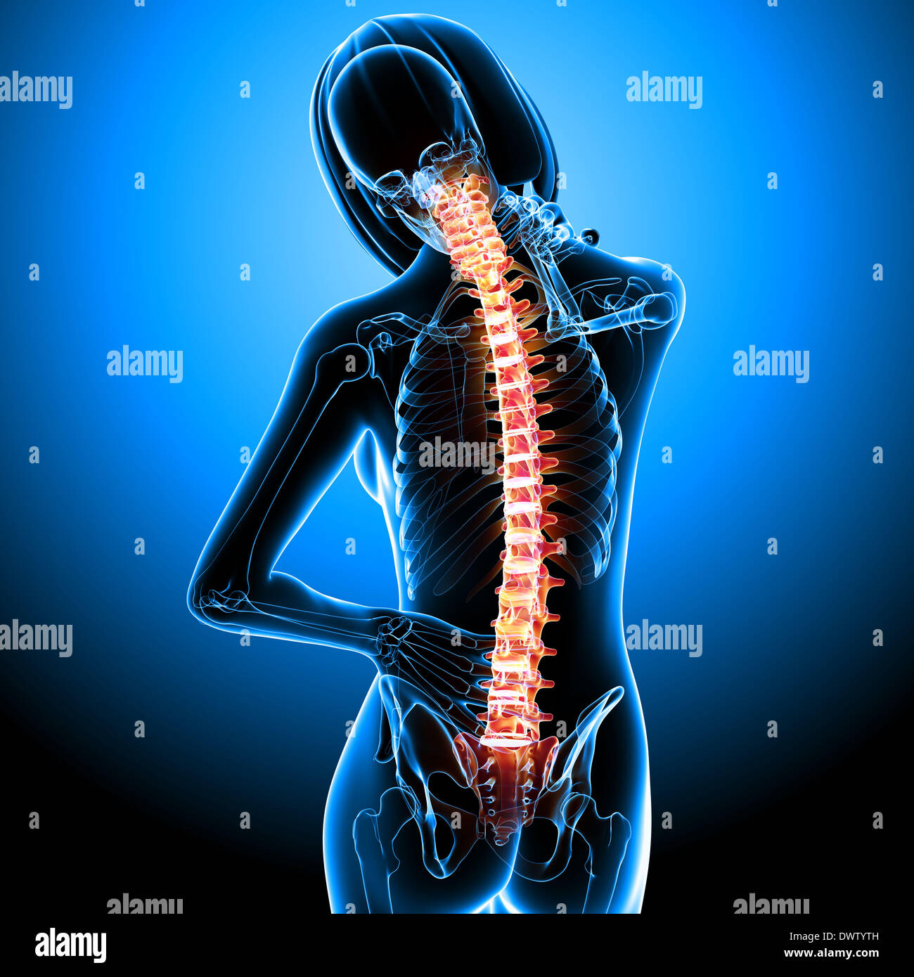 Cervicalgia woman drawing hi-res stock photography and images - Alamy