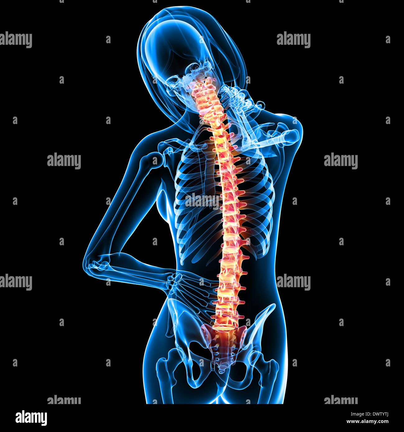 Back pain woman drawing Stock Photo - Alamy