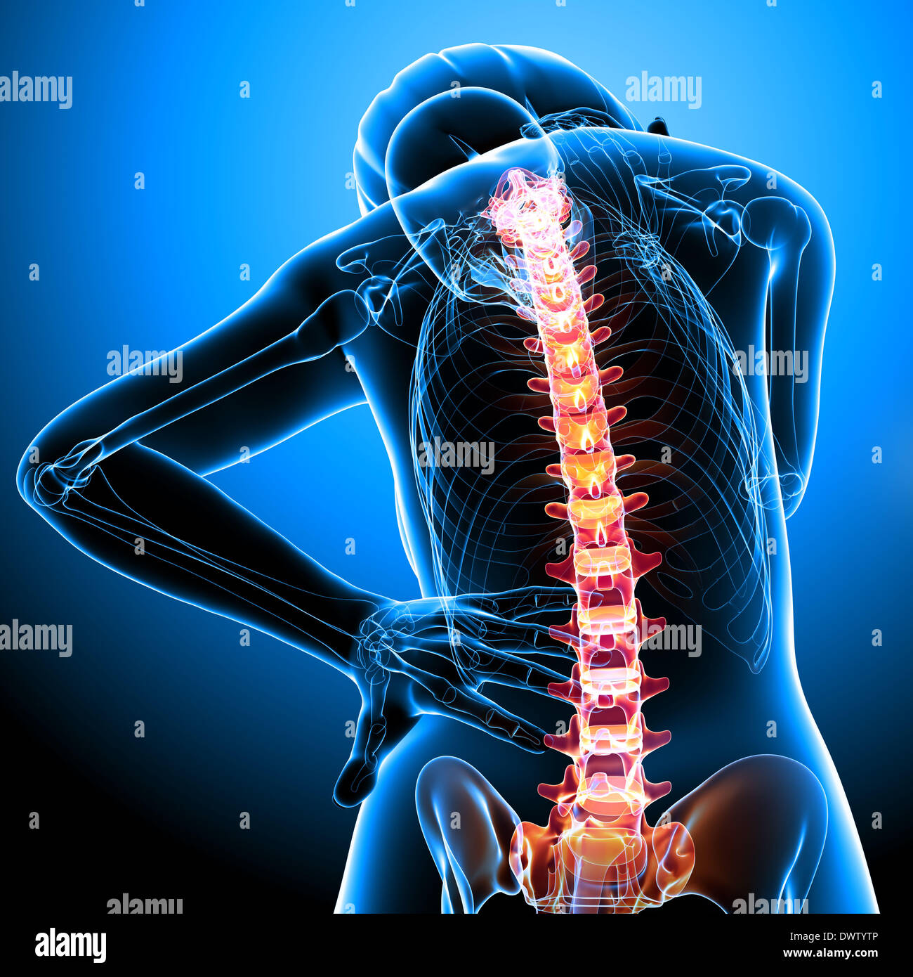 Back pain woman drawing Stock Photo - Alamy