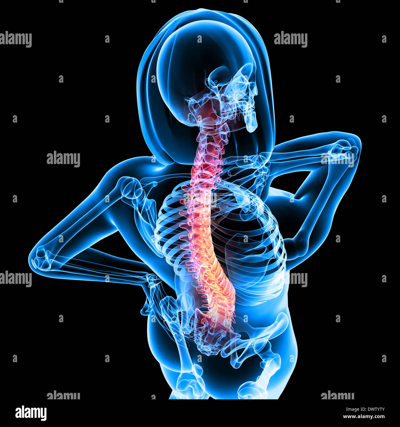 Back pain woman drawing Stock Photo - Alamy