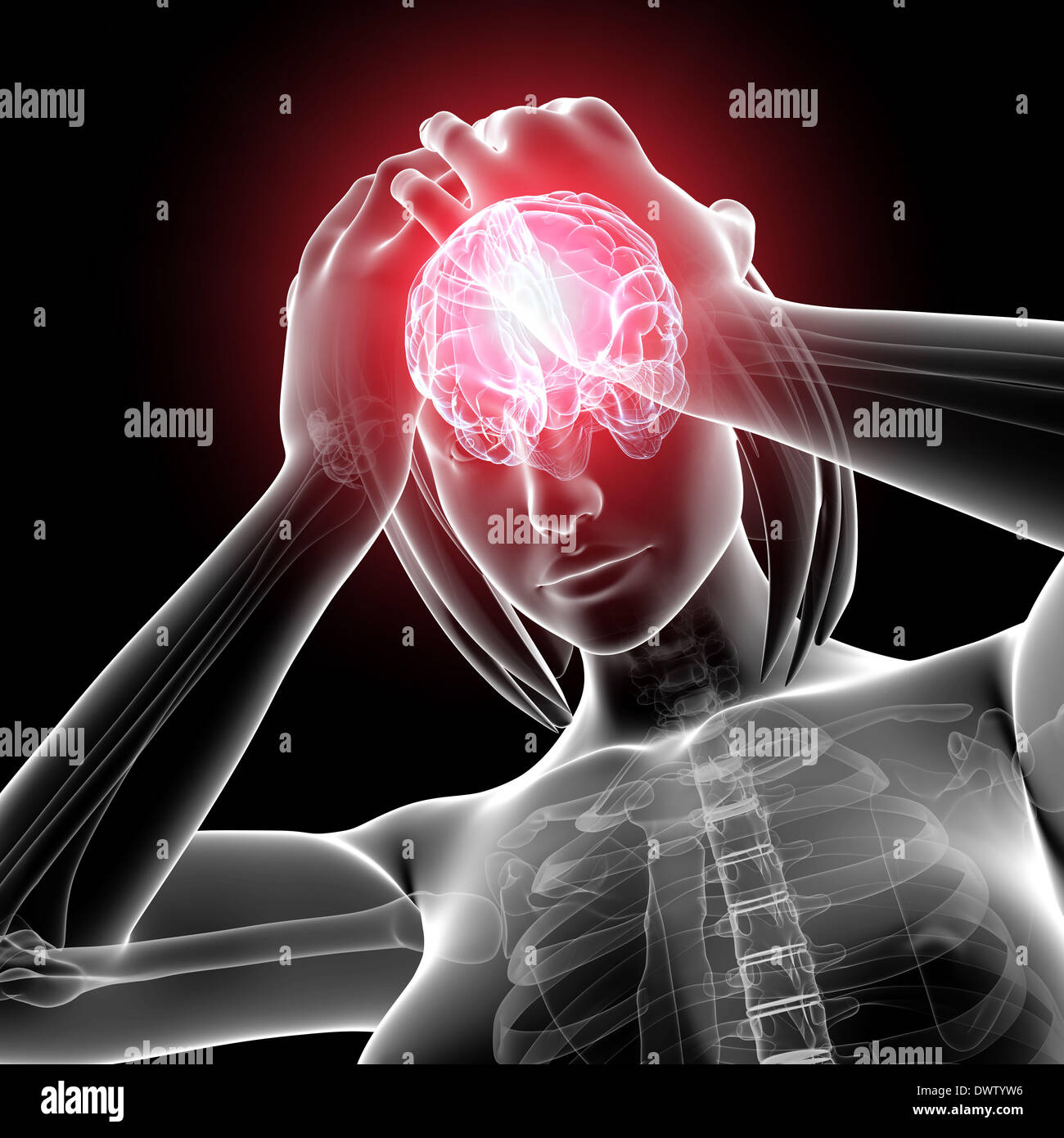 Headache concept drawing Stock Photo - Alamy
