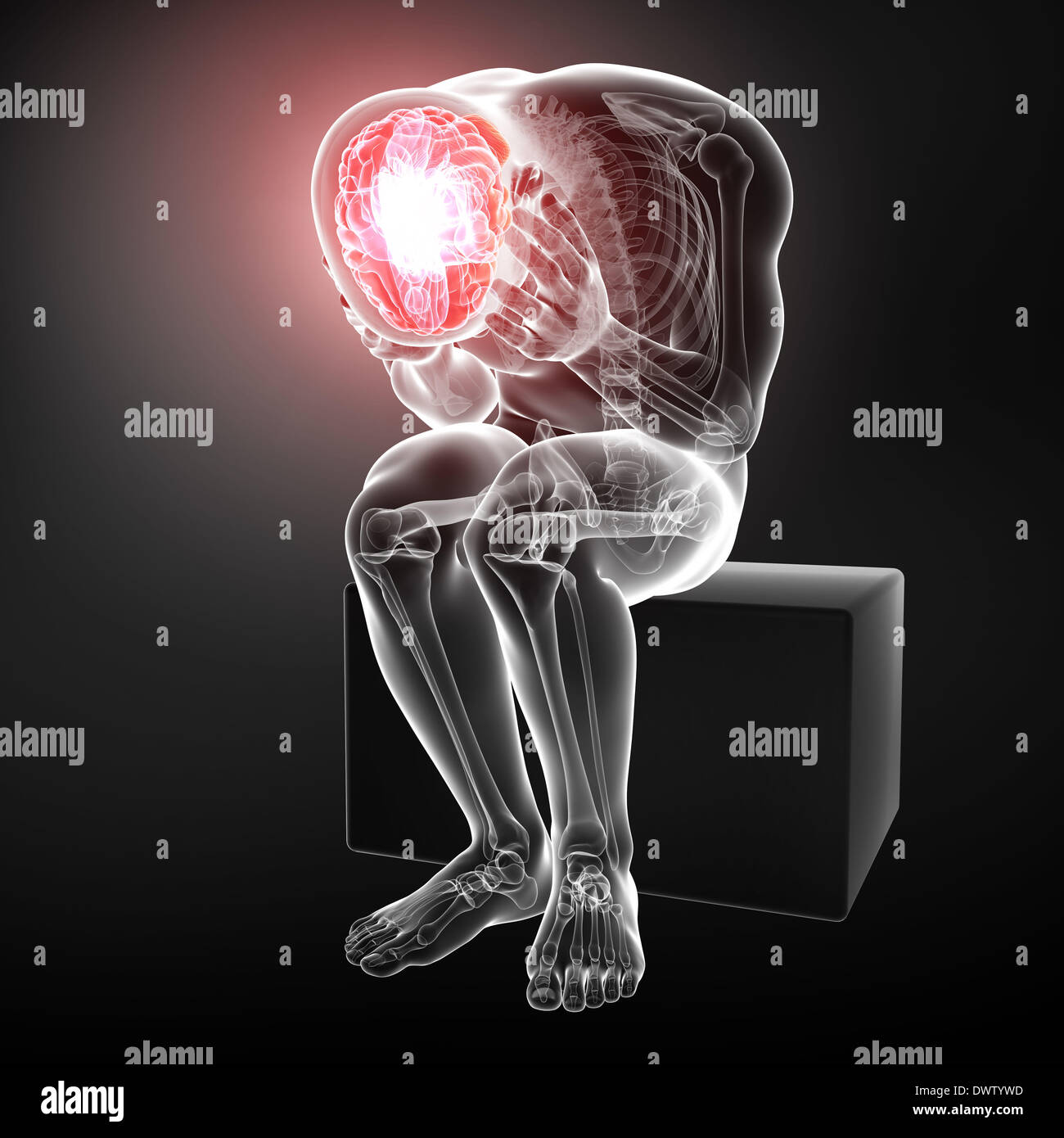 Headache man drawing Stock Photo - Alamy