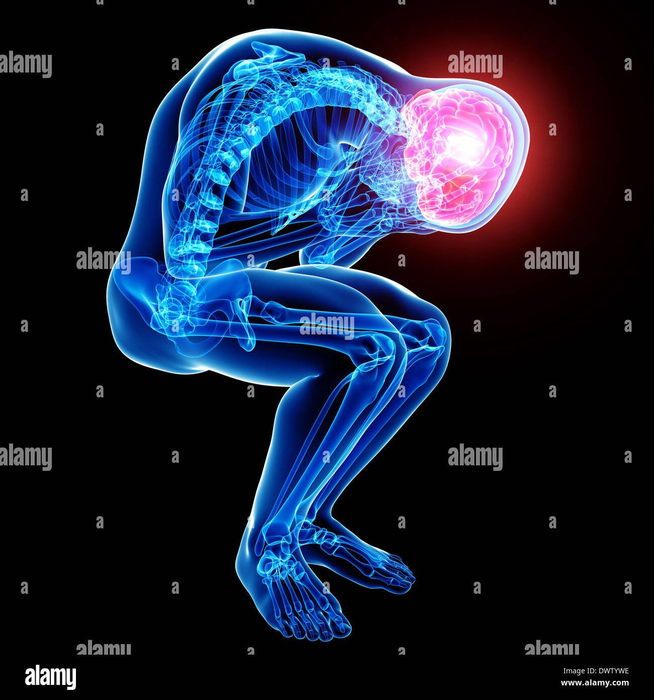 Headache man drawing Stock Photo - Alamy