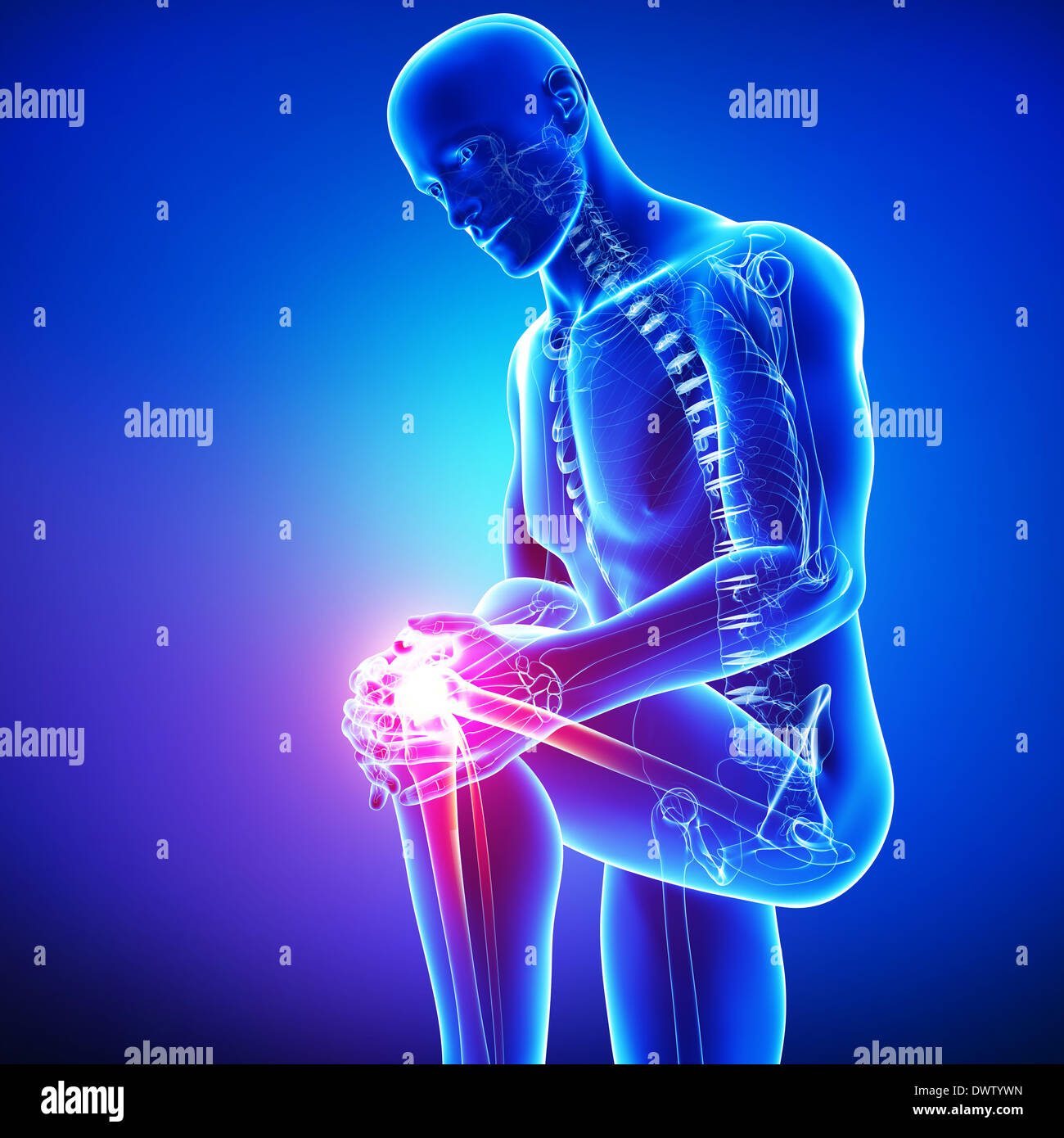 Pain knee man drawing Stock Photo - Alamy