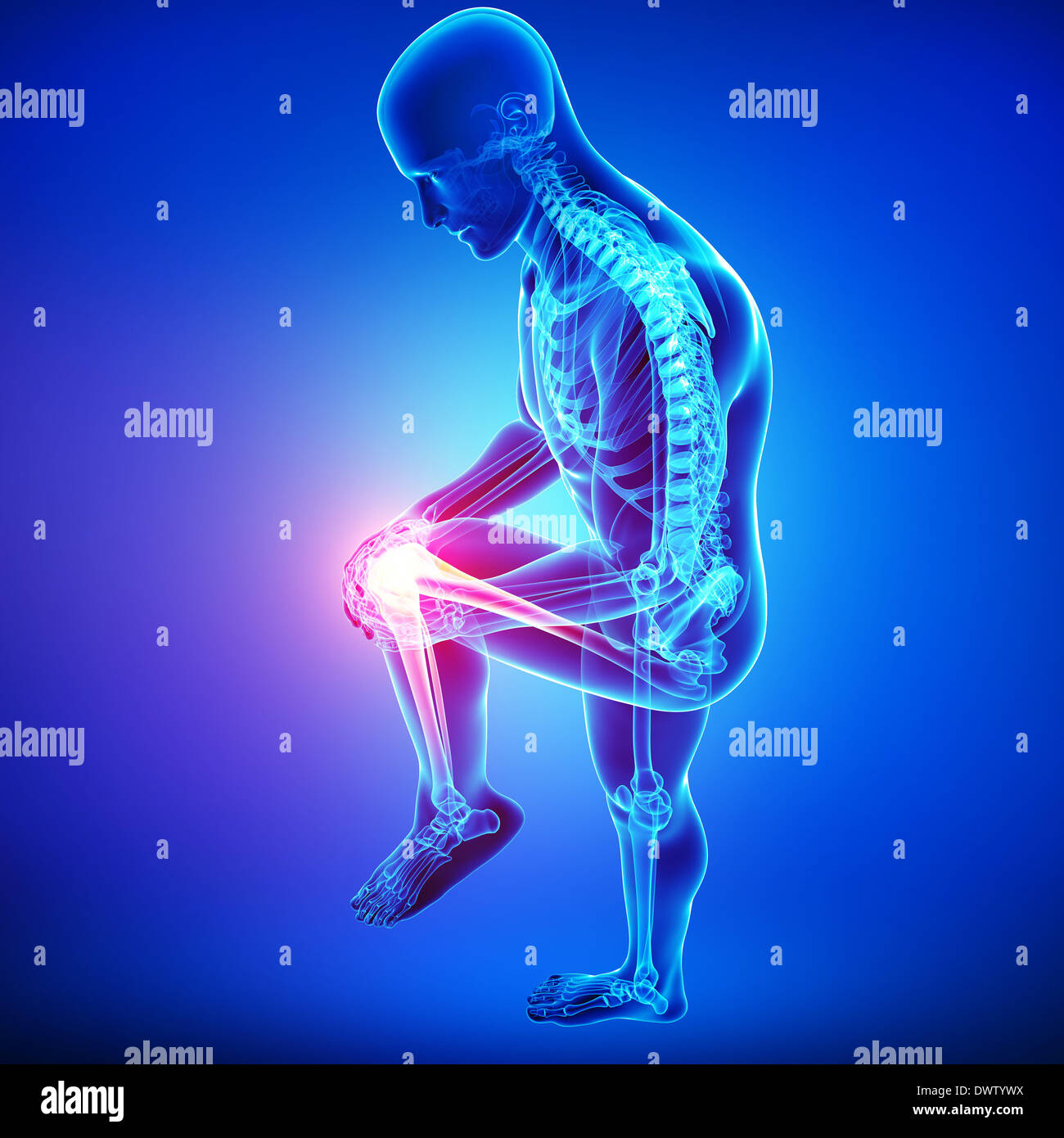 Pain knee man drawing Stock Photo - Alamy