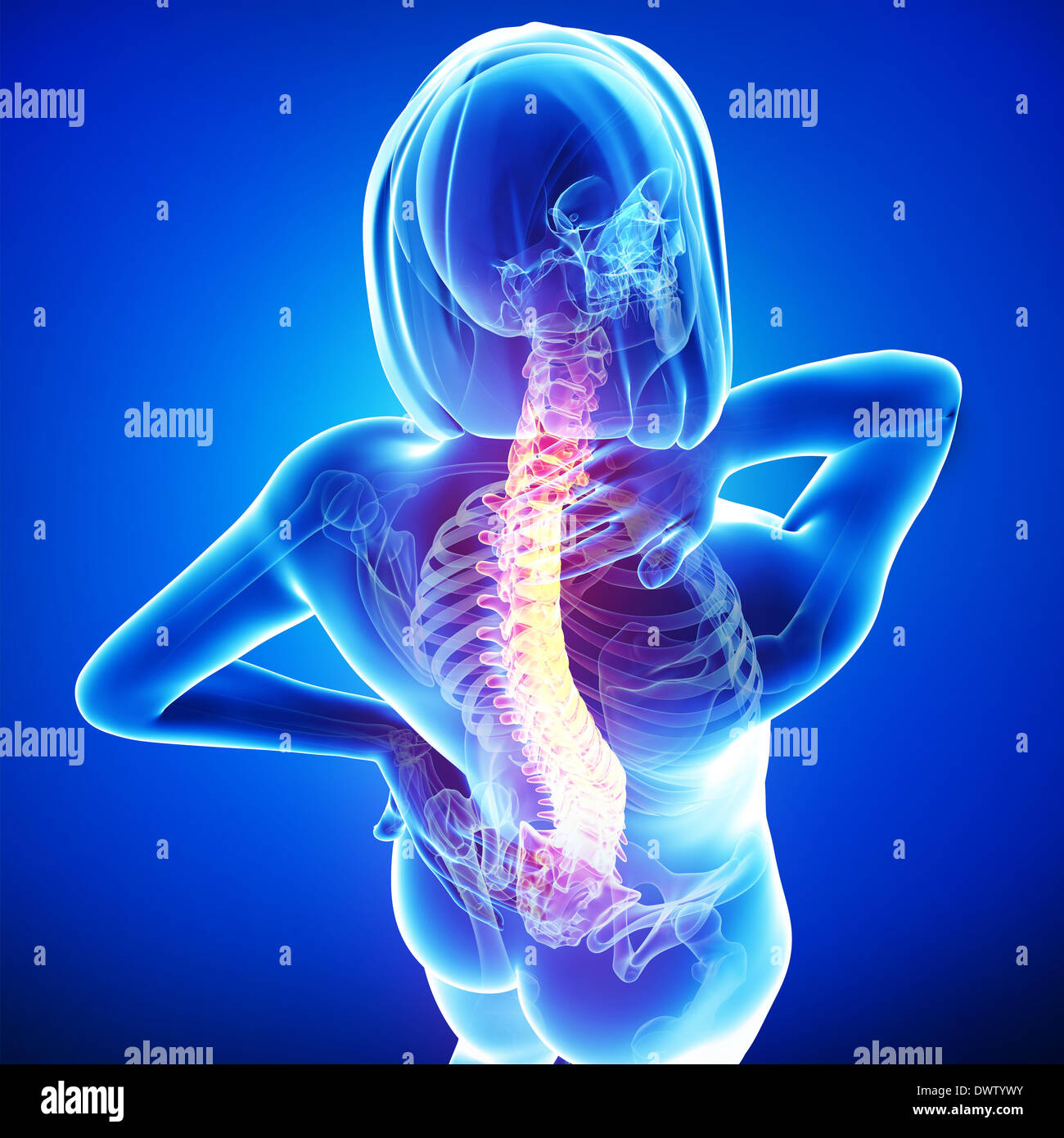 Back pain woman drawing Stock Photo - Alamy