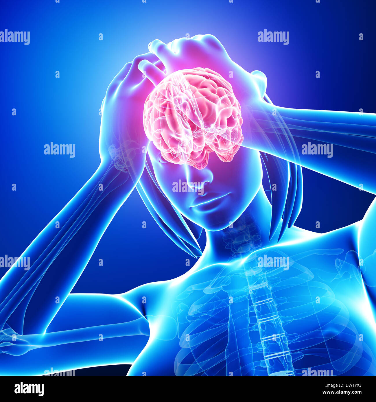 Headache concept drawing Stock Photo - Alamy