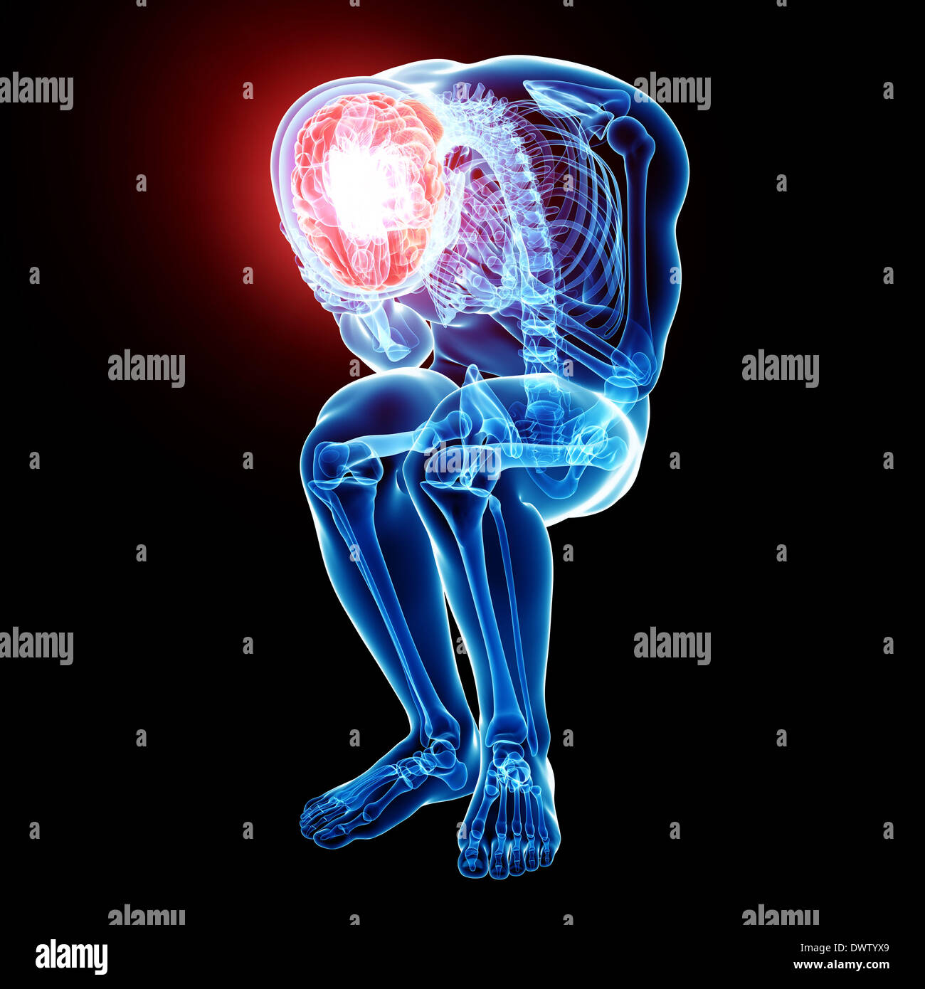 Headache man drawing Stock Photo - Alamy