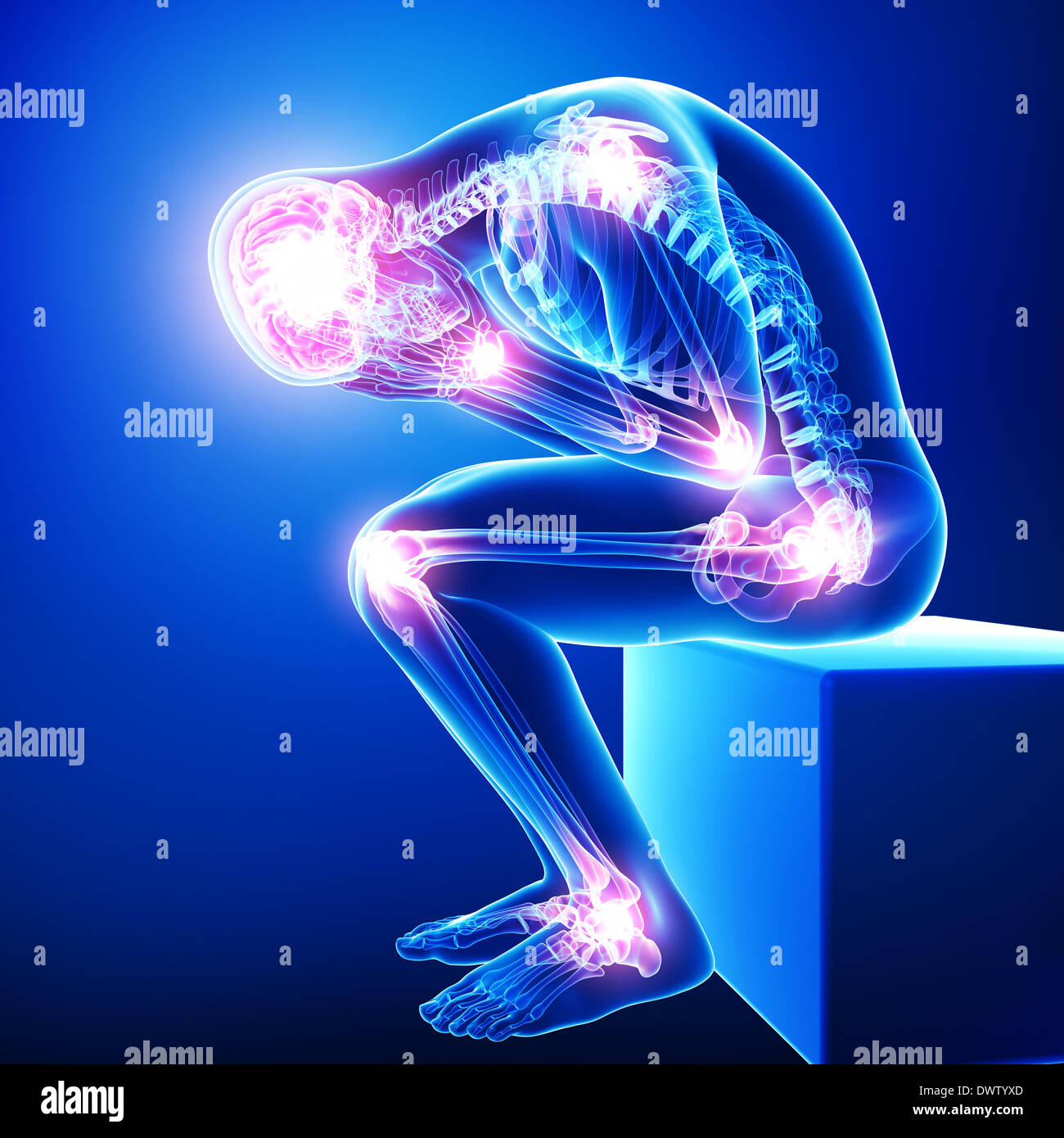 Headache man drawing Stock Photo - Alamy