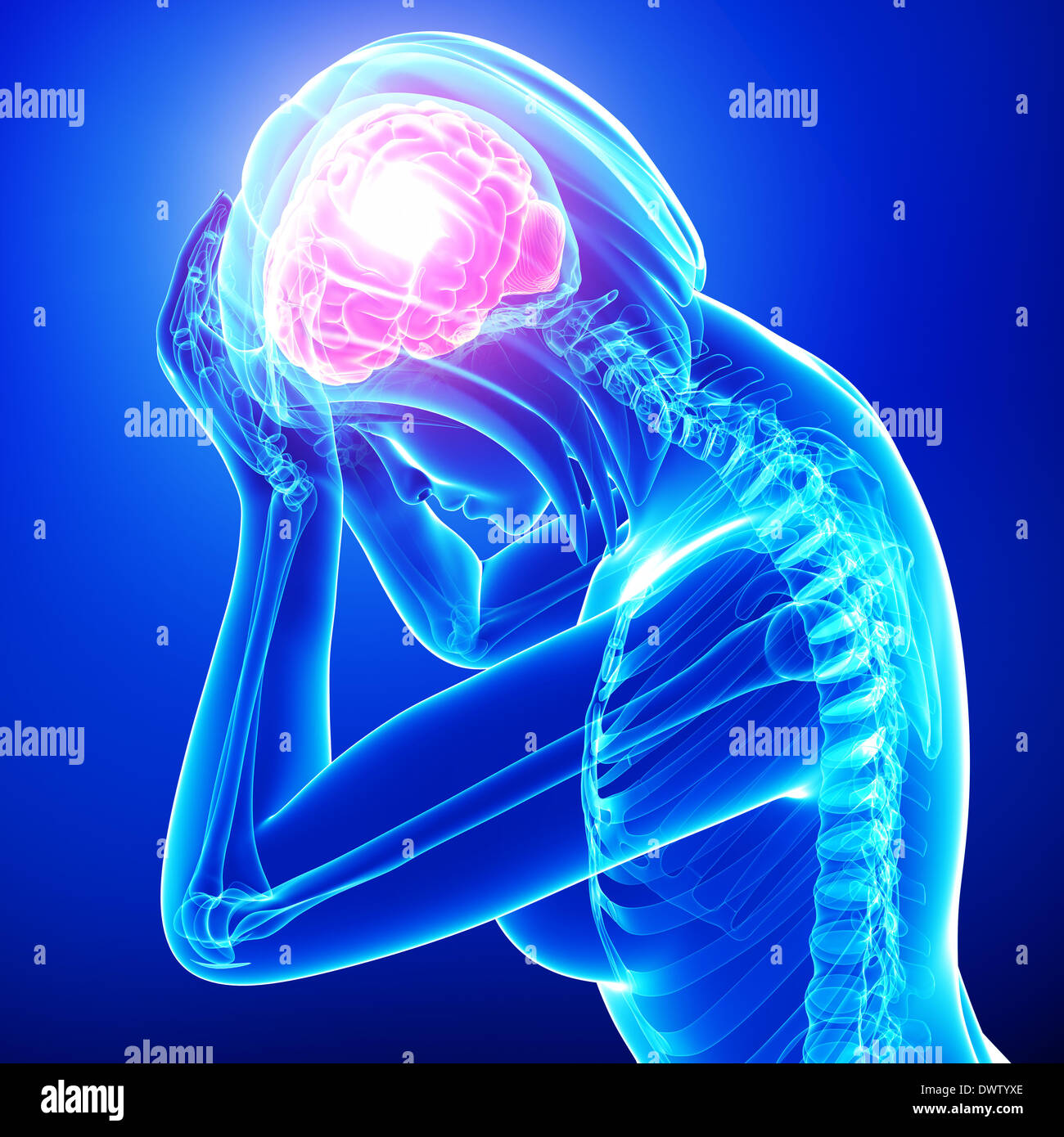 Headache concept drawing hi-res stock photography and images - Alamy