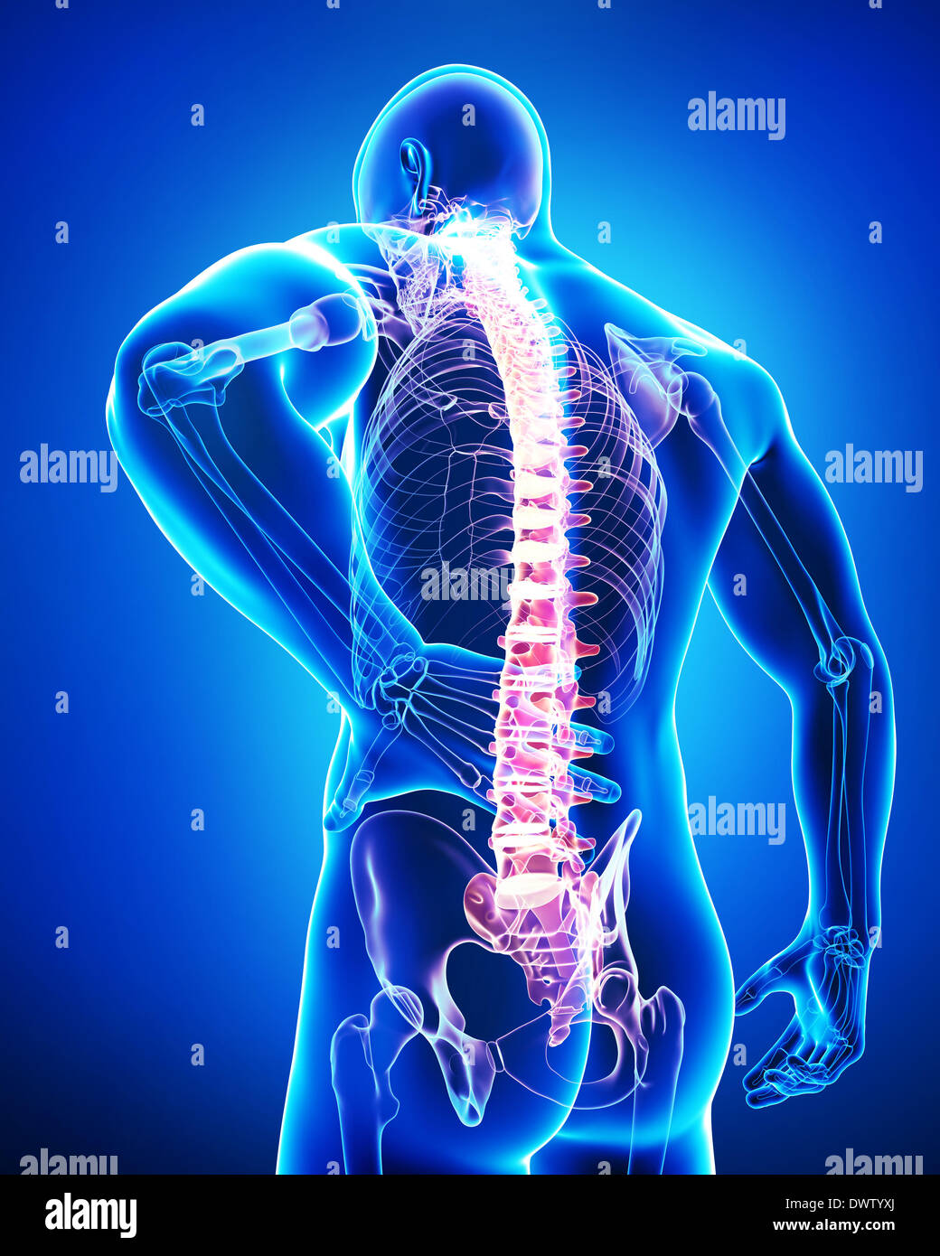 Back pain man drawing Stock Photo - Alamy