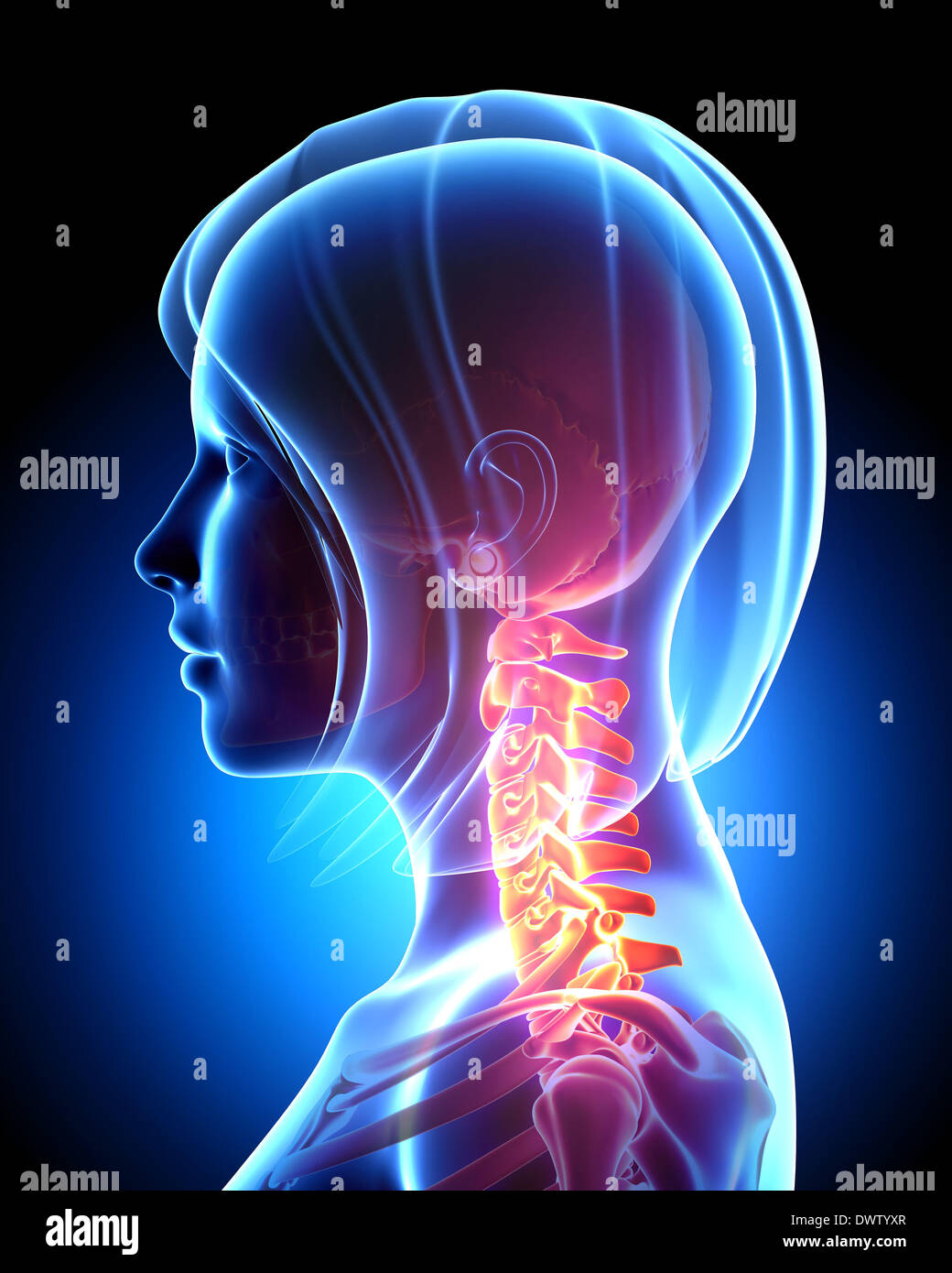 Cervical vertebra pain drawing Stock Photo - Alamy