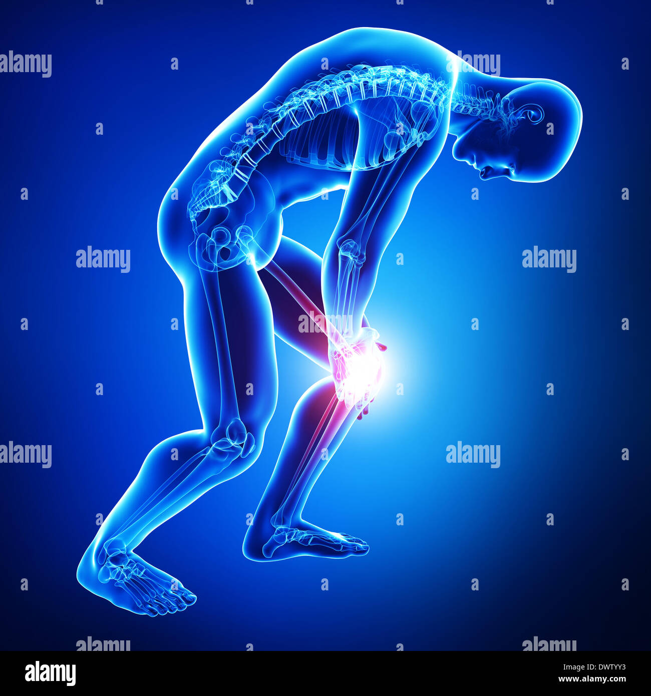 Pain knee man drawing Stock Photo - Alamy