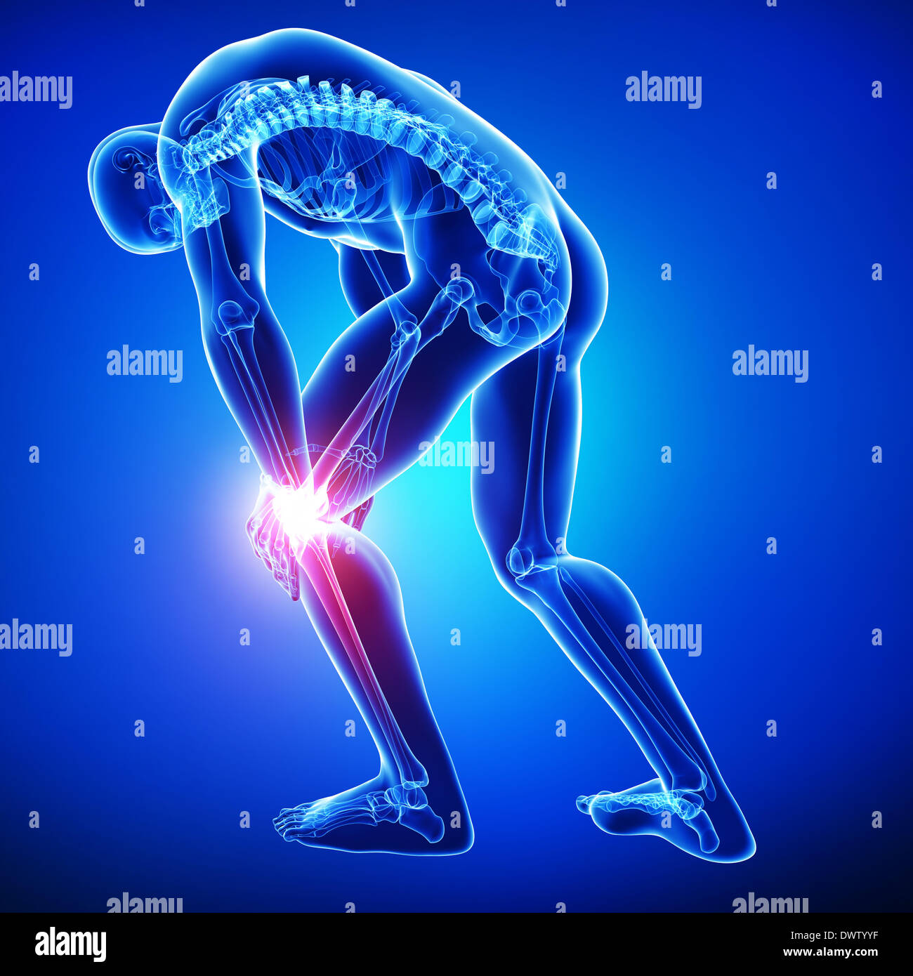 Pain knee man drawing Stock Photo - Alamy