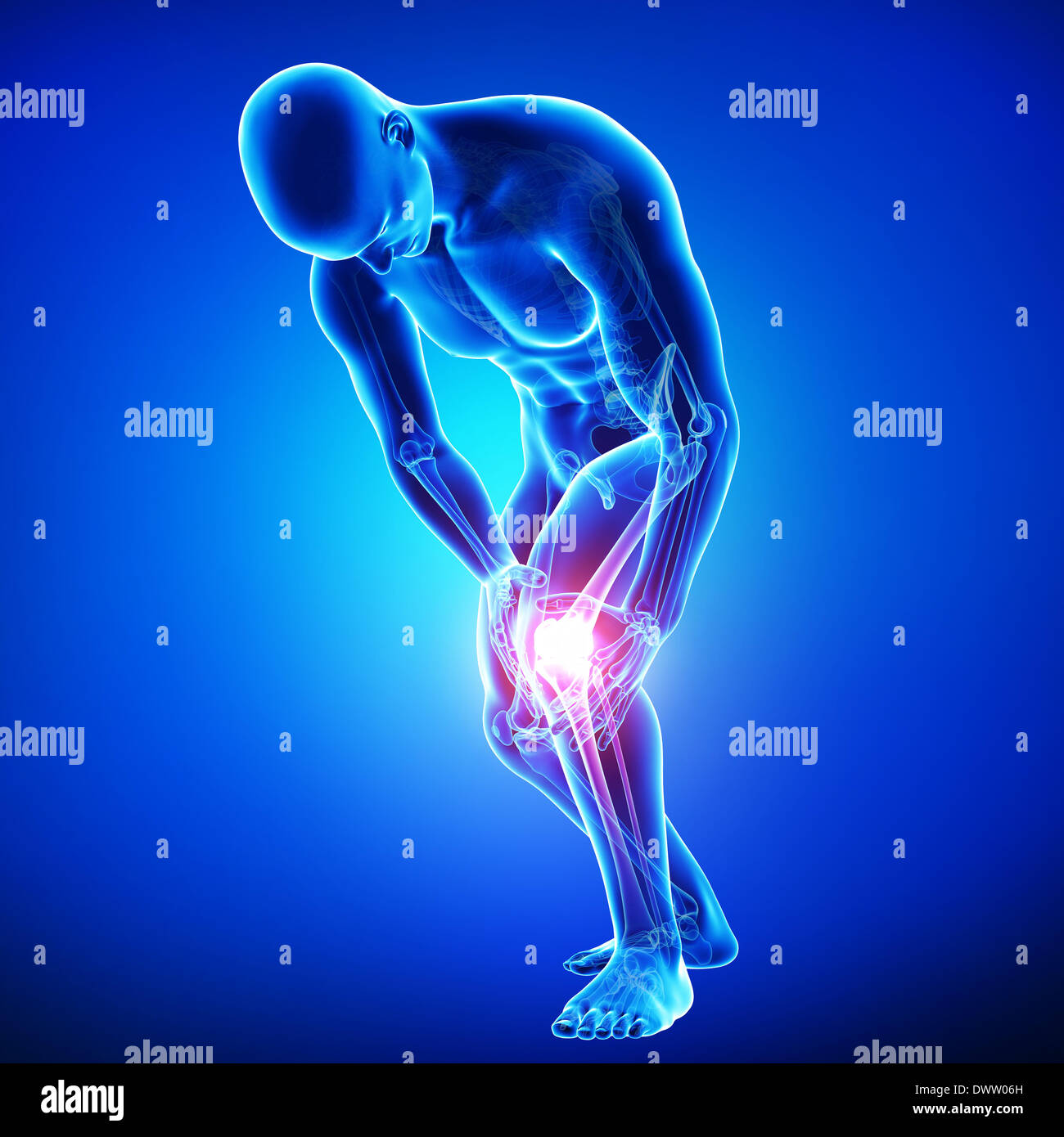 Pain knee man drawing hi-res stock photography and images - Alamy