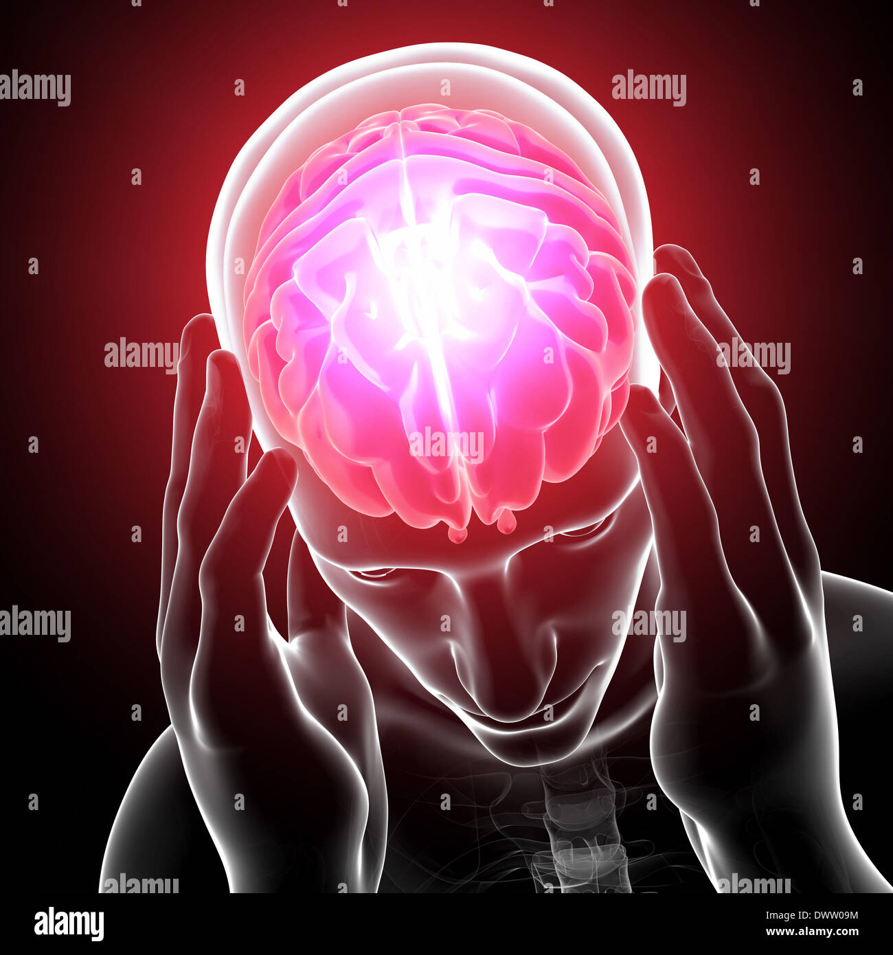 Headache concept drawing Stock Photo - Alamy