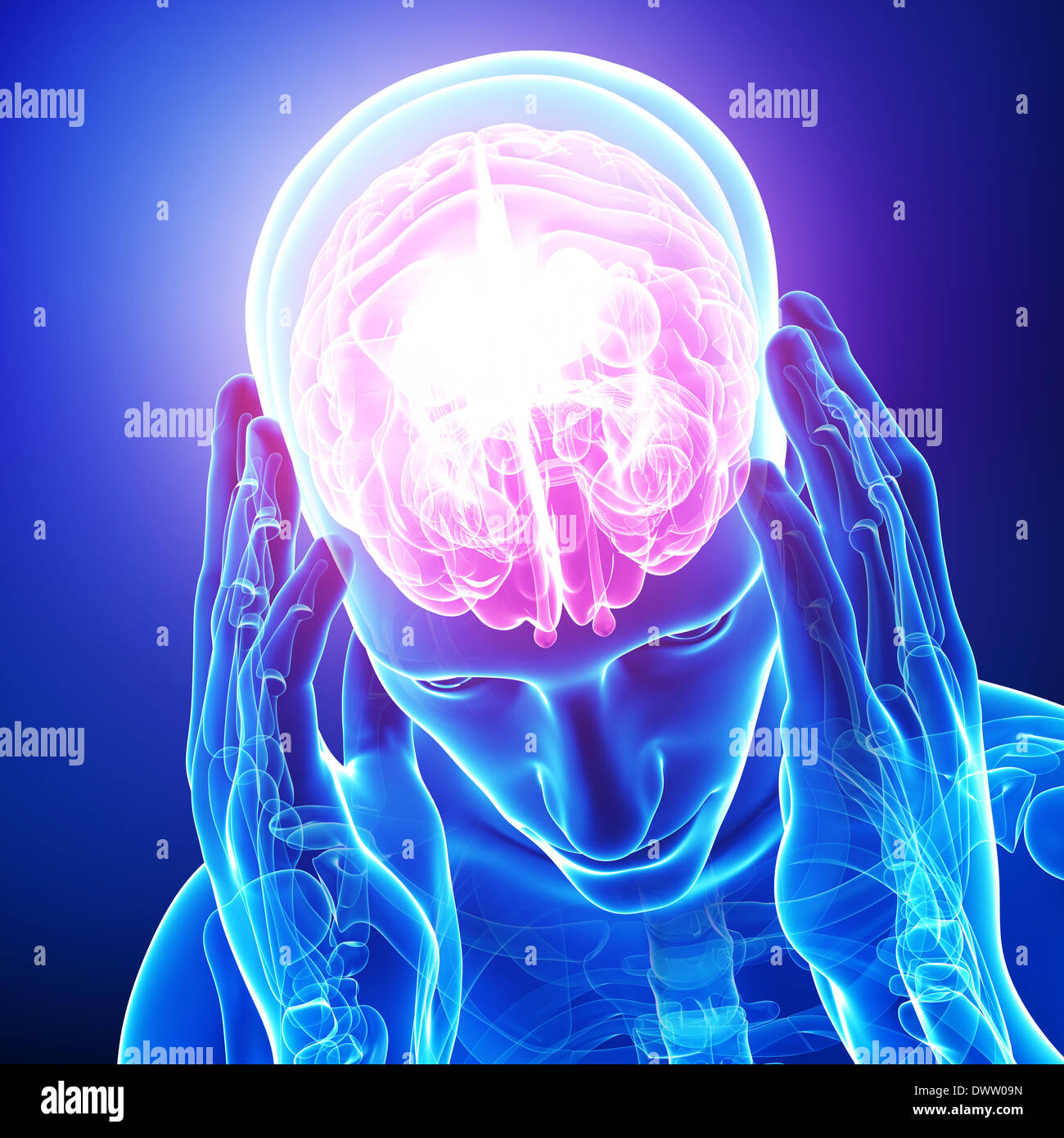 Headache concept drawing Stock Photo - Alamy