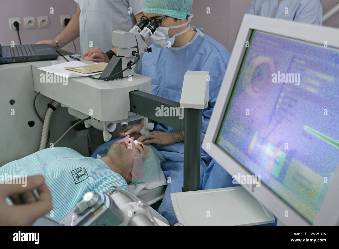 Surgery laser eye Stock Photo - Alamy