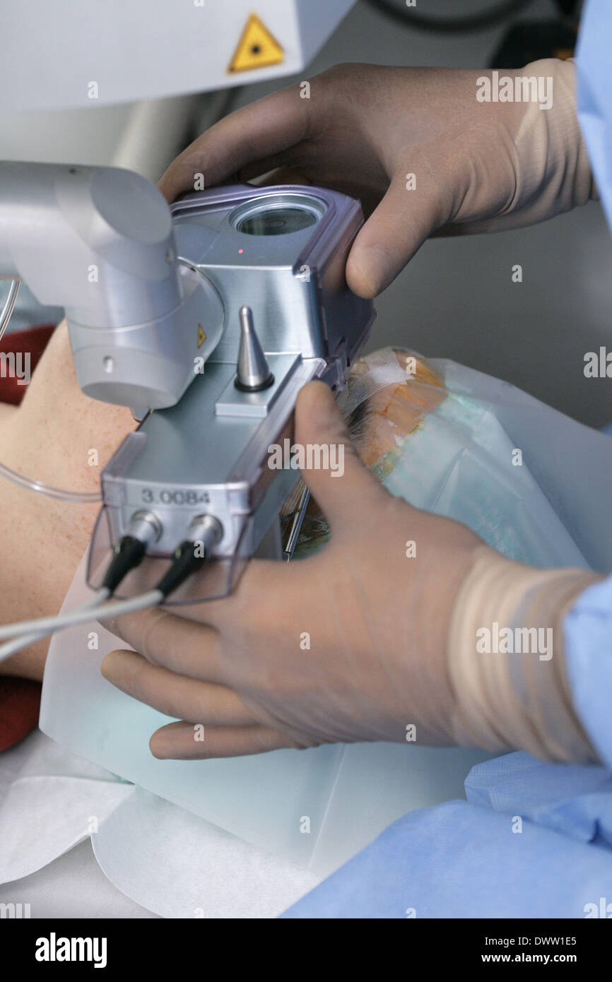 Surgery laser eye Stock Photo - Alamy