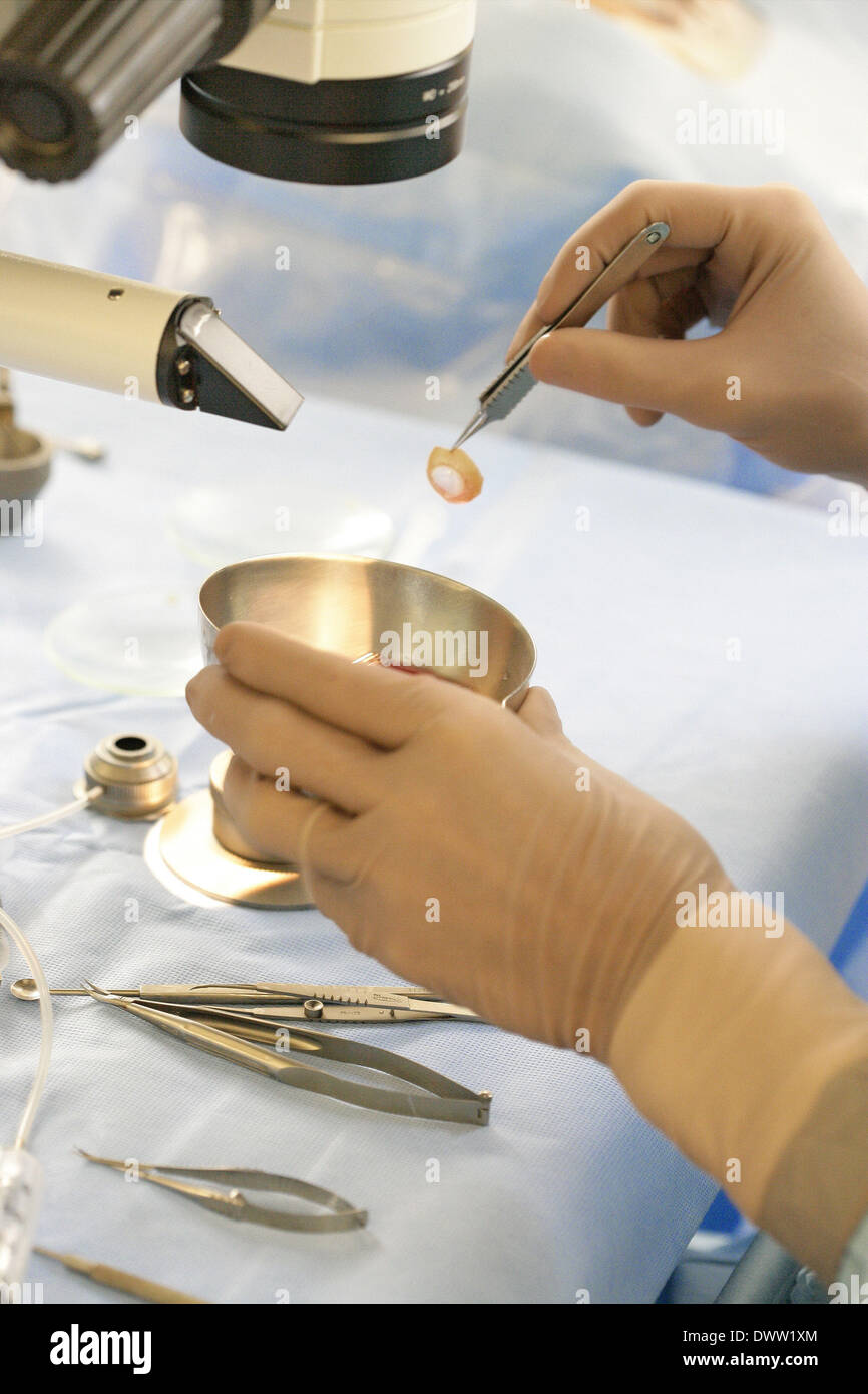 Transplant cornea eye surgery Stock Photo - Alamy