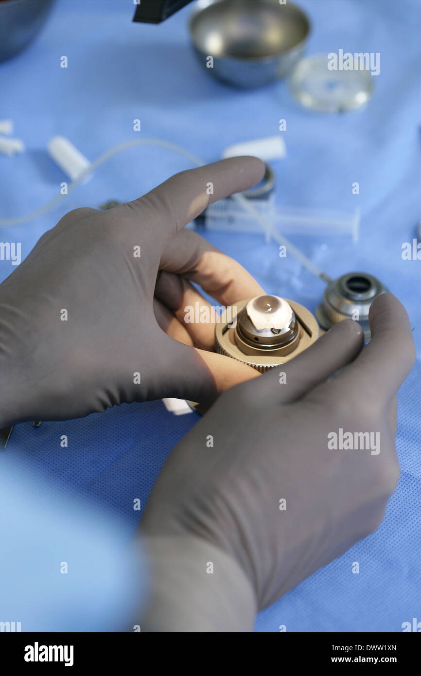 Transplant cornea eye surgery Stock Photo - Alamy