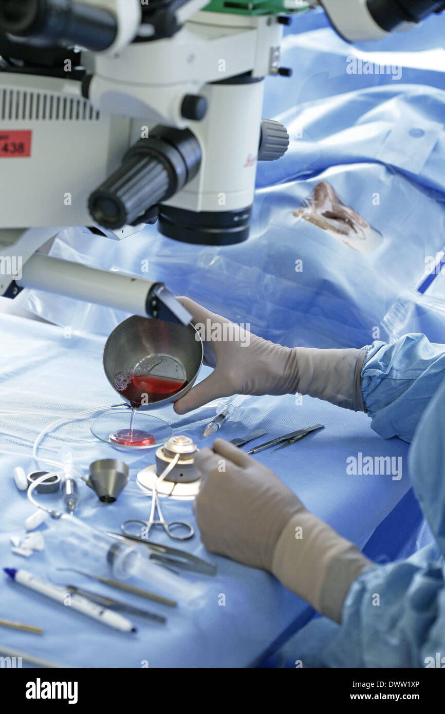 Transplant cornea eye surgery Stock Photo - Alamy