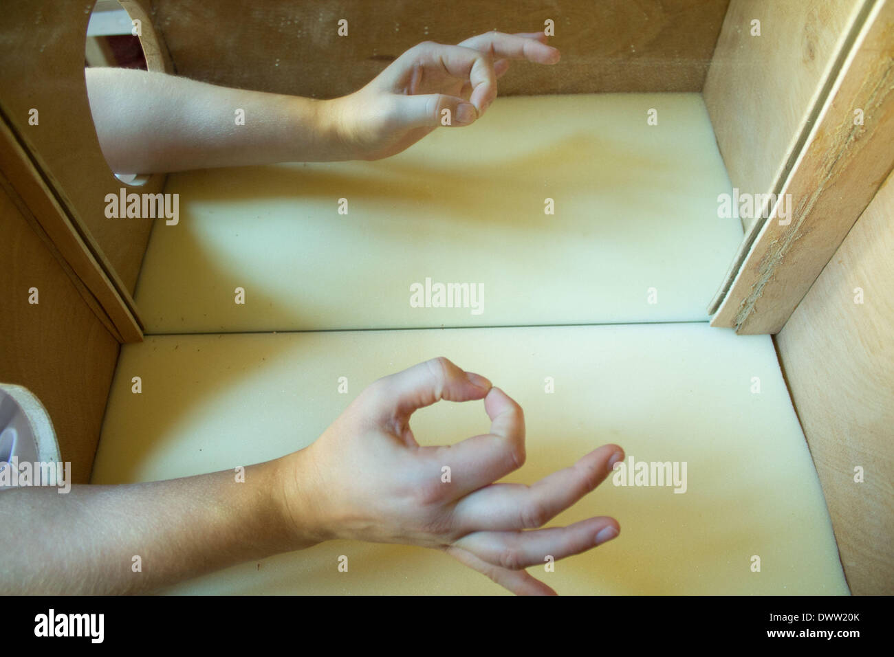 Upper limb paralysis hi-res stock photography and images - Alamy