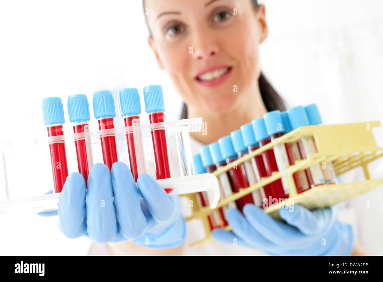 Lipid analysis hi-res stock photography and images - Alamy