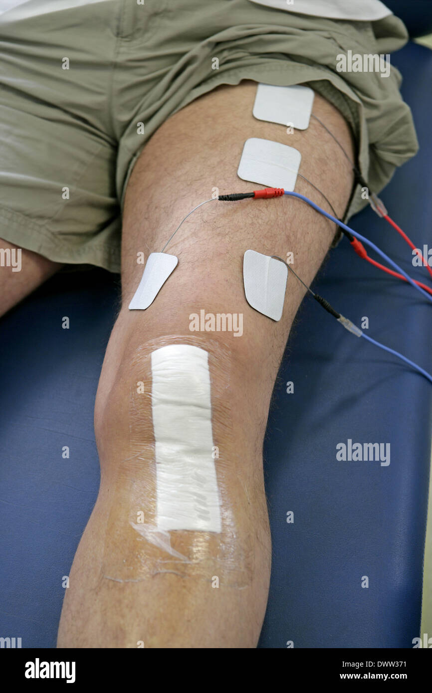 Electrotherapy hi-res stock photography and images - Alamy