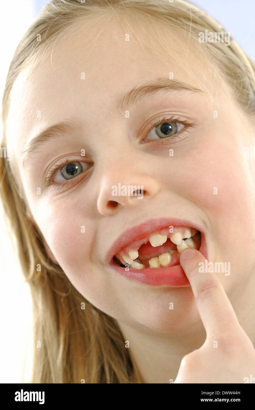 Tooth child portrait Stock Photo - Alamy