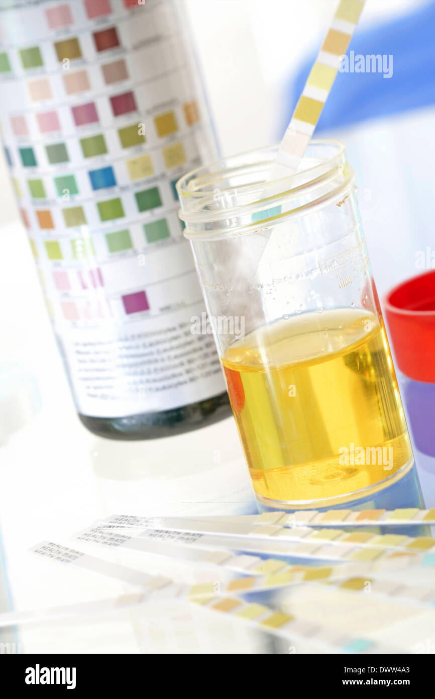 Urine test strip Stock Photo - Alamy