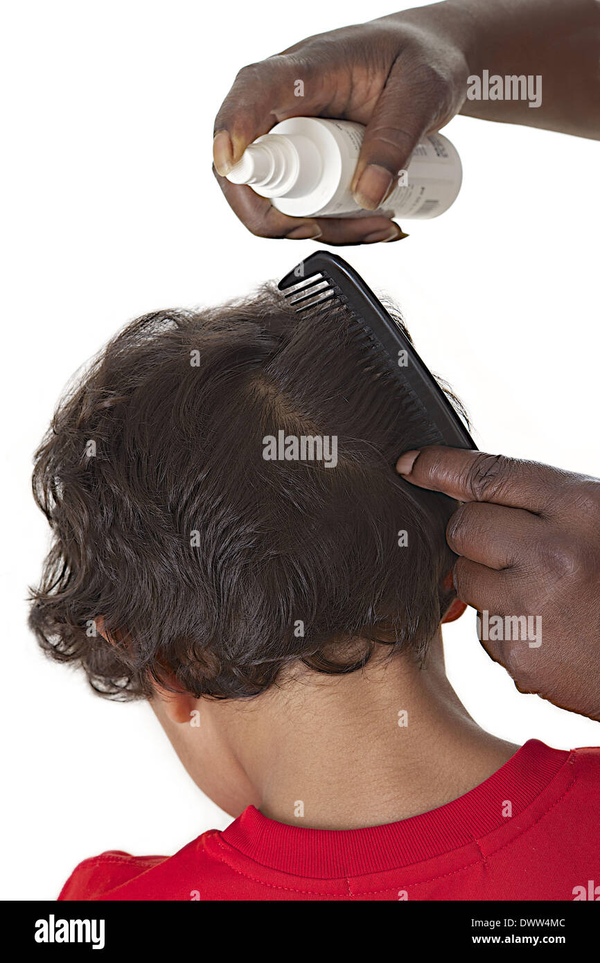 Treatment louse child Stock Photo - Alamy
