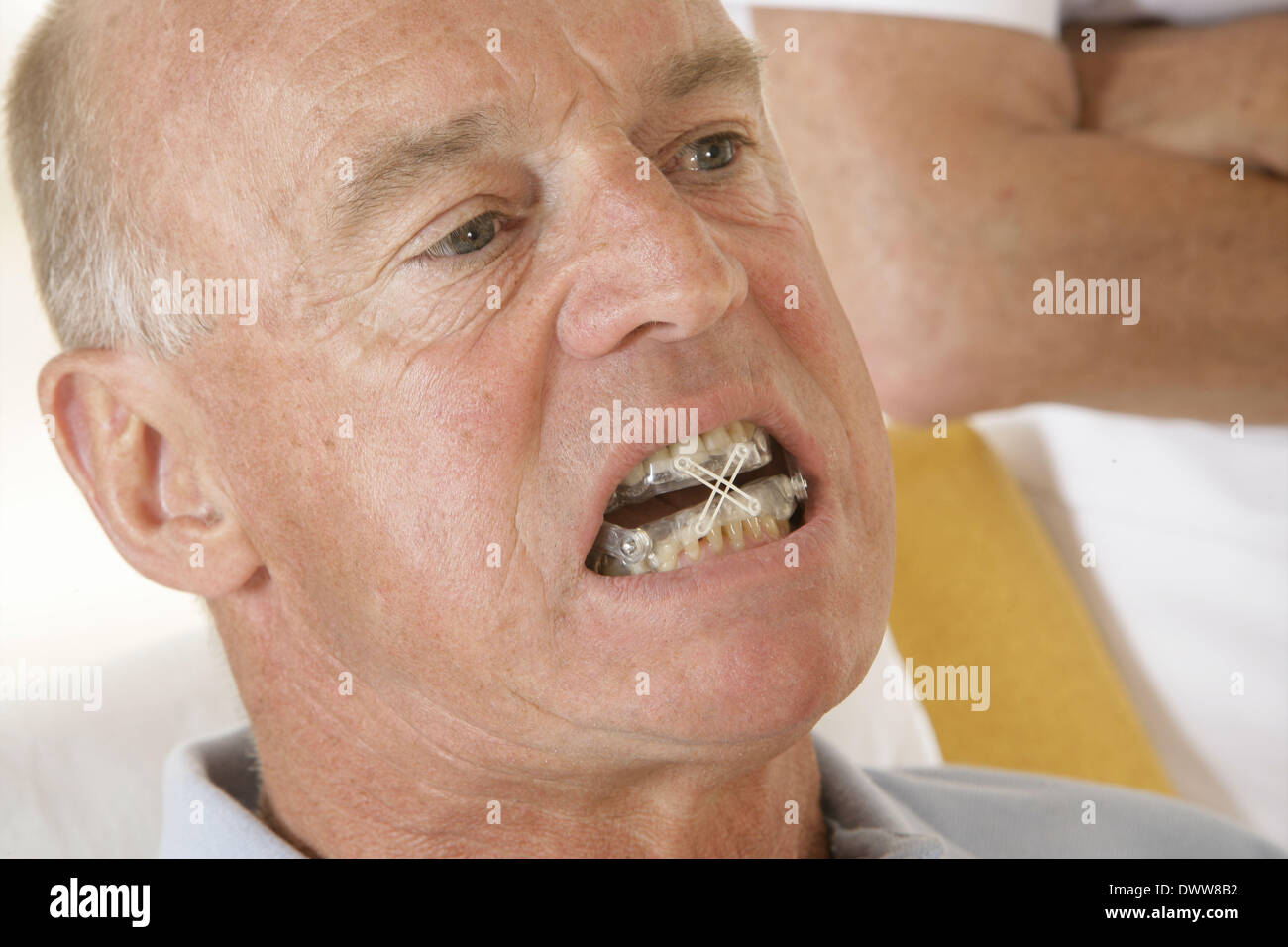 Mandibular advancement splint hi-res stock photography and images - Alamy