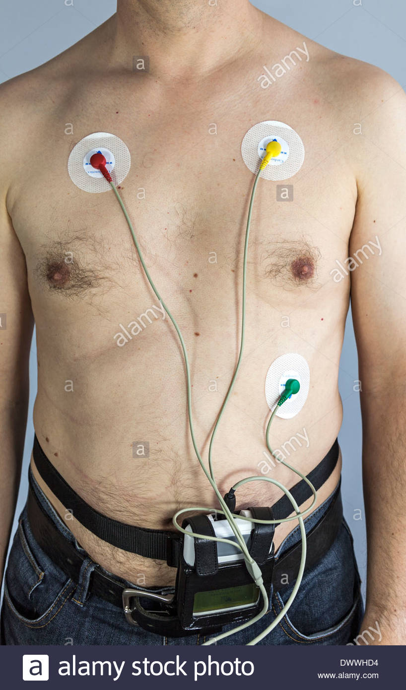 Electrodes Chest High Resolution Stock Photography and Images - Alamy