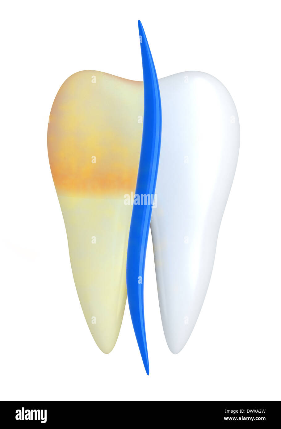 Bad human Tooth (done in 3d, isolated Stock Photo - Alamy