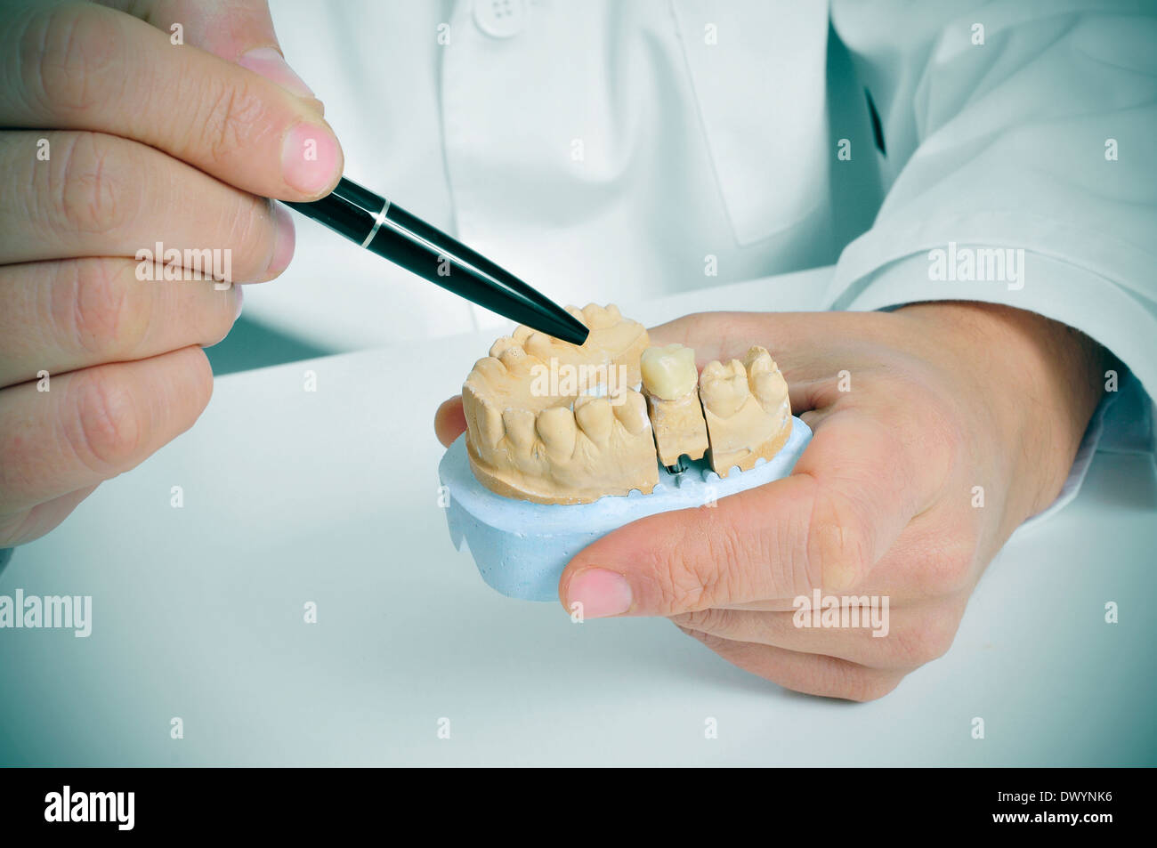 a dentist pointing a prosthesis in a dental mould Stock Photo - Alamy